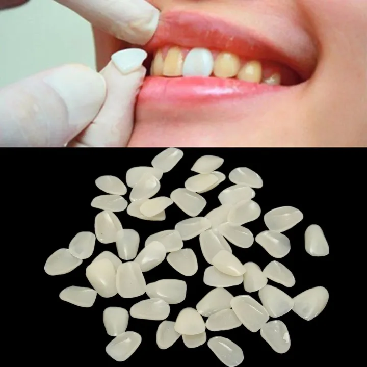 3x50pcs Dental Ultra Th-in Porcelain Teeth Medical Veneers Resin Teeth ...