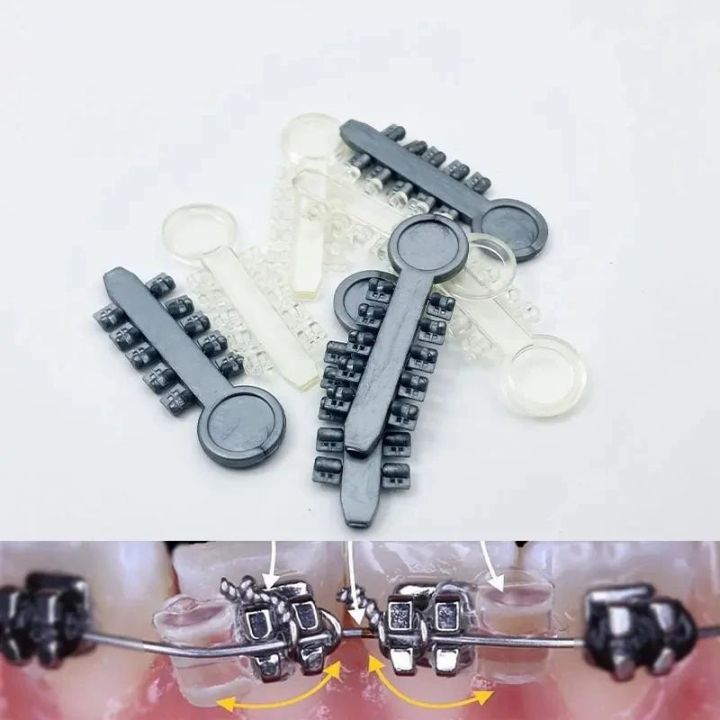 Dental Orthodontic Rotation Wedges For Archwire Brackets Braces ...
