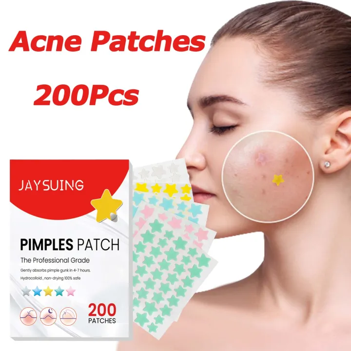 200Pcs Repair Acne Patch Fade Blemishes Pimple Marks Closed Acne ...