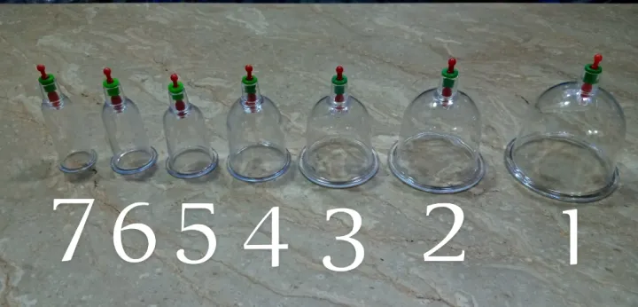 Hijama Cups/Cupping Therapy Cups/vacuum cups(100 pcs set) | Daraz.pk