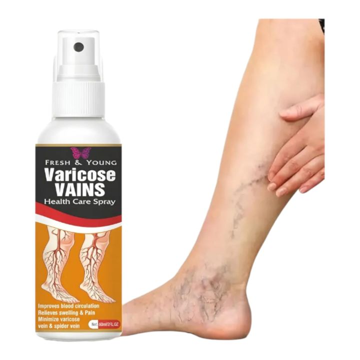 Varicose Veins Spray | Natural Formula for Fast Relief | Reduces ...