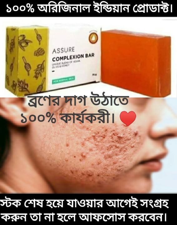 Assure Complexion bar Soap 75g Indian Honey is enriched with olives and ...