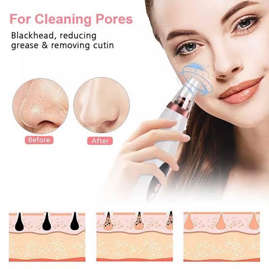 Black Spots Removal Face Nose Deep Cleaner | Daraz.com.bd