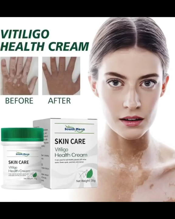 Skin care vitiligo health cream 35g 1pcs | Daraz.com.np