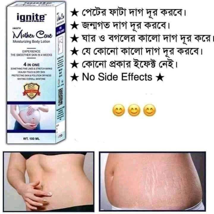 ignite natural Moisturizing Skin Lotion Smoothe-Mother`s Care 250ml ...