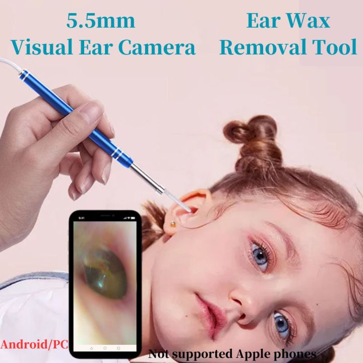 Visual Otoscope for Android/PC Ear Picker 5.5mm Endoscope Camera Ear ...