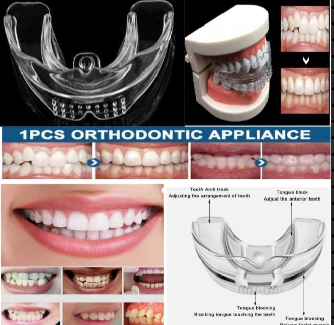 Dental Orthodontic Silicone Mouth Guard Teeth Straightener Dental ...