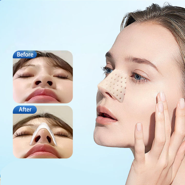Low Temperature Nose Job Rhinoplasty Splint Ortho Immobilized ...