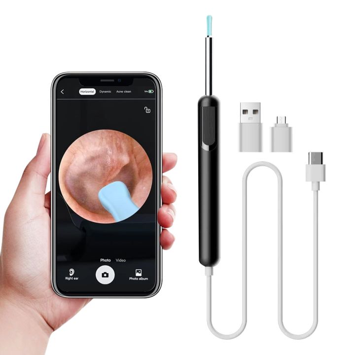 Ear Wax Removal Tool Smart Ear Cleaner Ear Camera Scope with Light ...