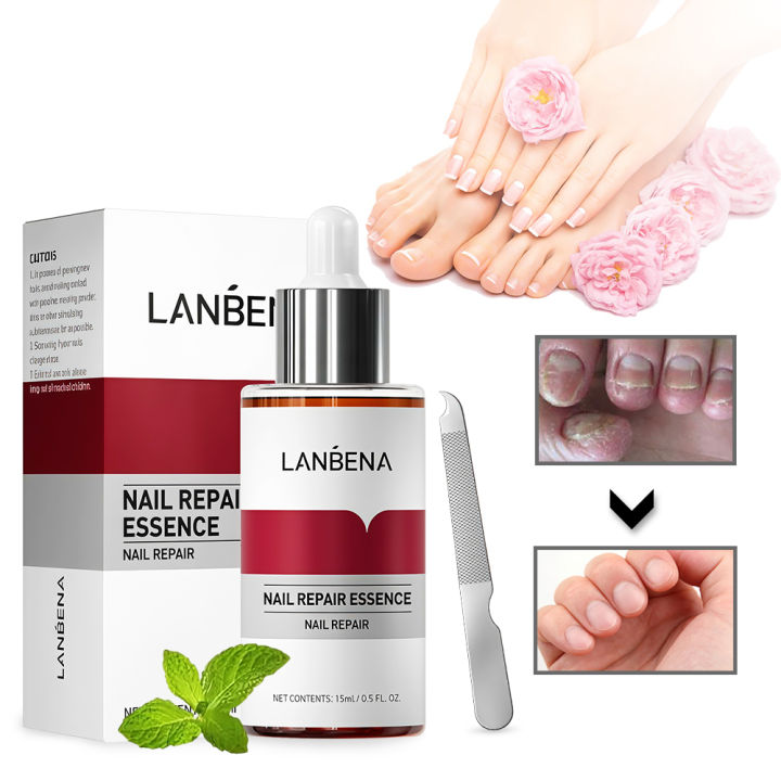 Nail Fungus Treatment Serum Foot Toe Nail Fungal Removal Repair Essence ...