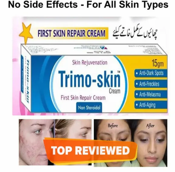 Trimo Skin Cream Skin Whitening for Face, Scar Removal, Acne, Hand ...