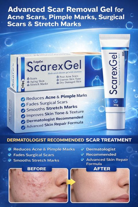 Scarex Gel 30g | Advanced Scar Removal Gel for Acne Scars, Pimple Marks ...