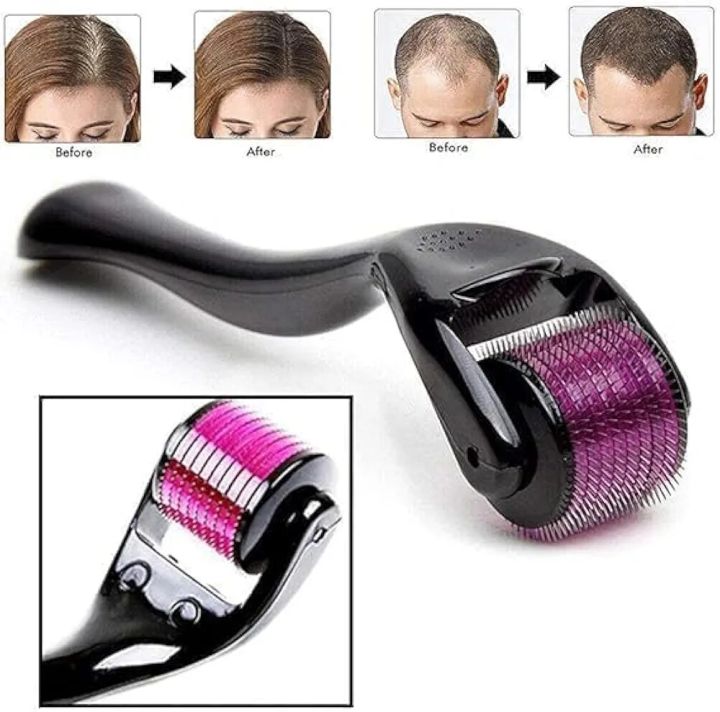 Microneedle Derma Roller for Hair Loss – Safe & Effective Scalp Therapy ...