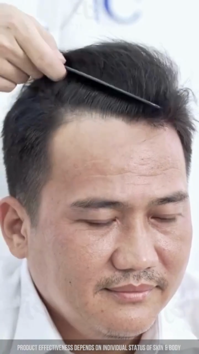 FEG Plus Beard & Hair Growth Serum Spray | Natural Beard Booster & Hair ...