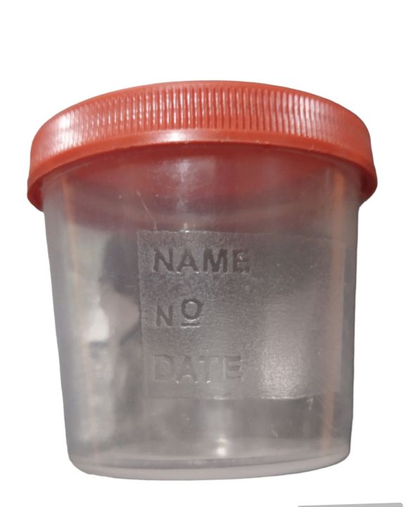 Sputum Container,Cup 40ml (10 pcs pack) | Daraz.pk
