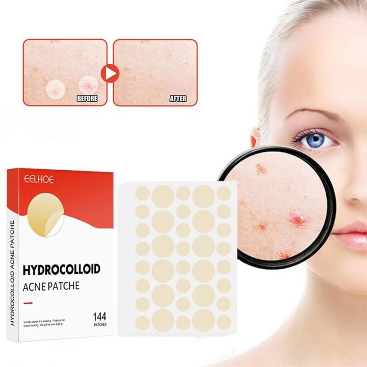 144pcs/set Face High-end Skin Care Pimple Acne Patches Professional ...