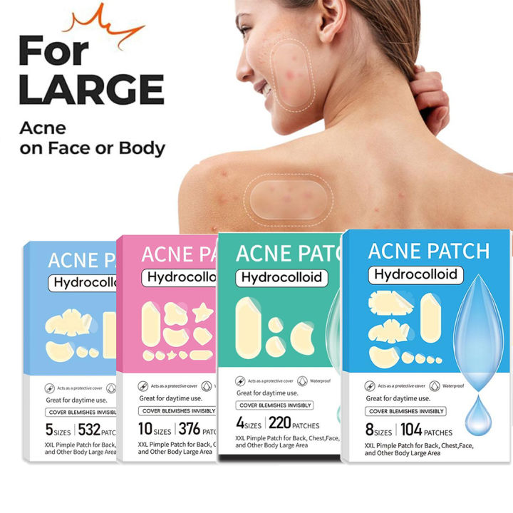 Large Pimple Patches Bulk for Face, 5 Sizes Hydrocolloid Acne Patches ...