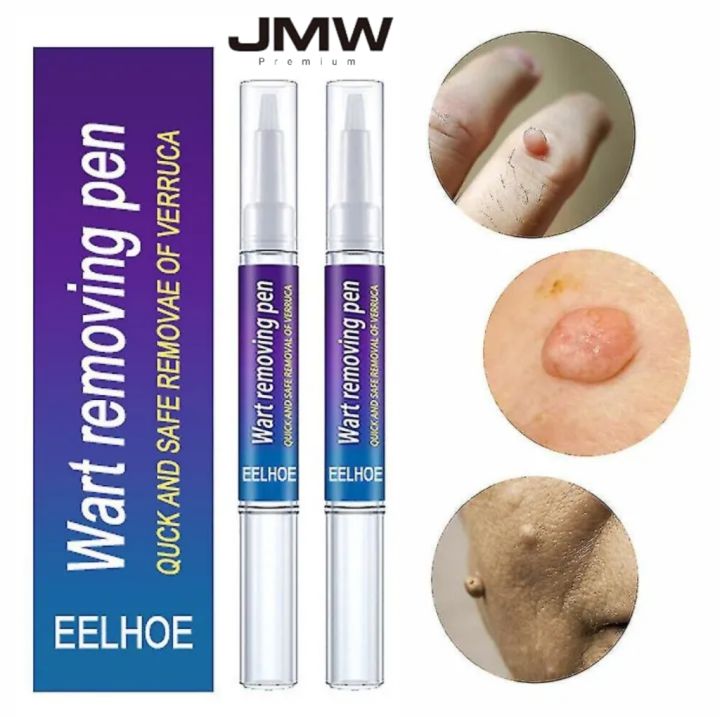 JMW Premium Removal Of Warts Liquid Pen Woman Skin Care Removing ...