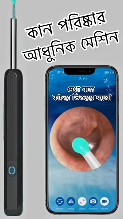 Bright, Clear, and Gentle – Smart Visual Ear Cleaner with HD Camera ...