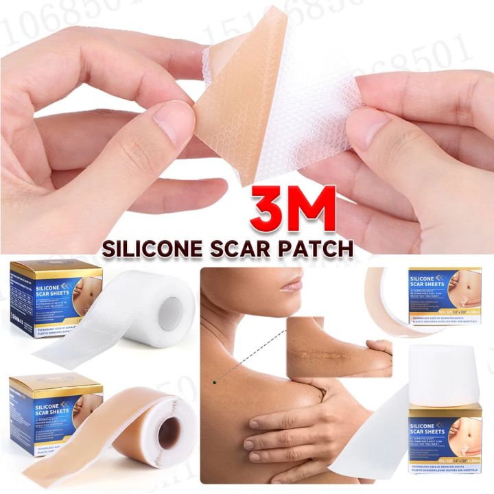 Silicone Scar Sheets Scar Reducing Tape 3M Tummy Tuck Tape Effective ...