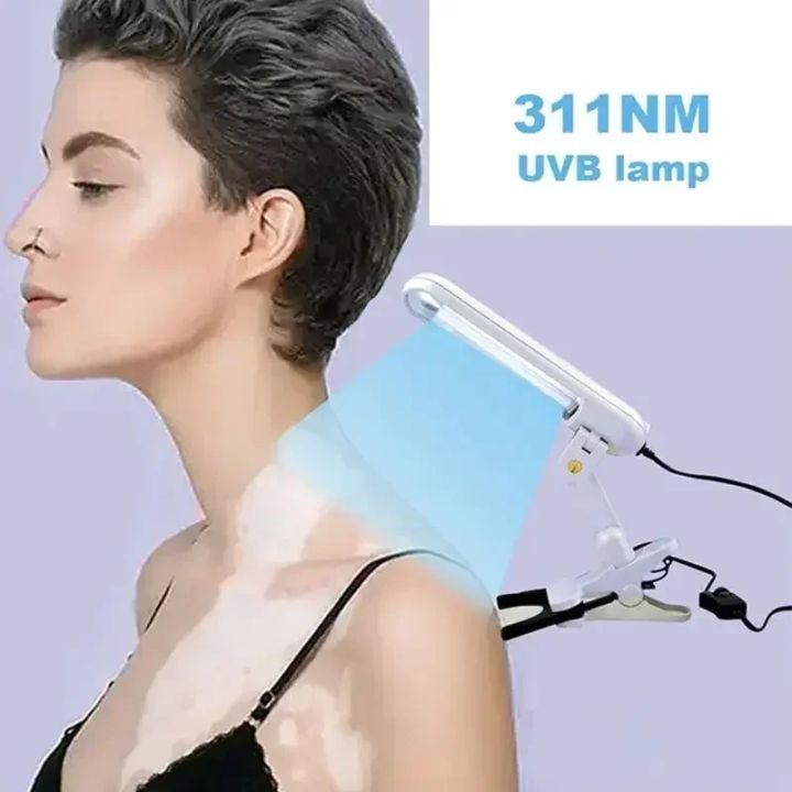 311nm UVB Phototherapy Lamp for Psoriasis Vitiligo Treatment Portable ...
