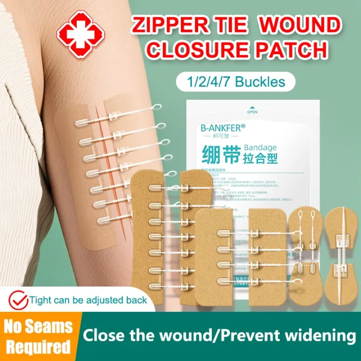 Zip Stitch Sutures Skin Laceration Closures Adhesive Bandages Zipper ...