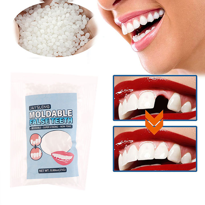 Resin 25g Temporary Tooth Repair Kit Teeth And Gaps False Teeth Solid ...