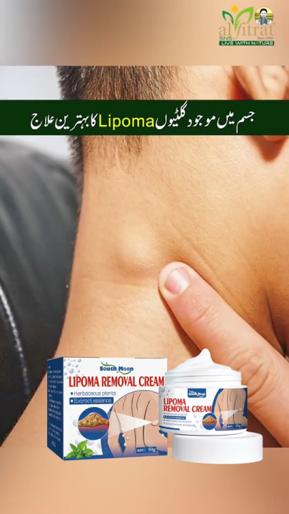 South Moon Lipoma Removal Cream 50g | Herbal Body Smoothing Ointment ...