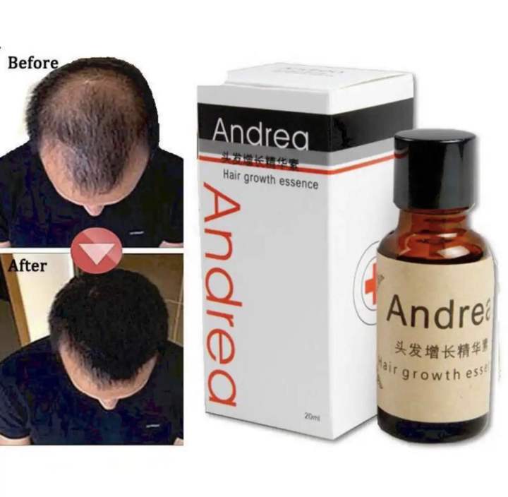 Andrea Hair Growth Oil 20ml | Daraz.lk
