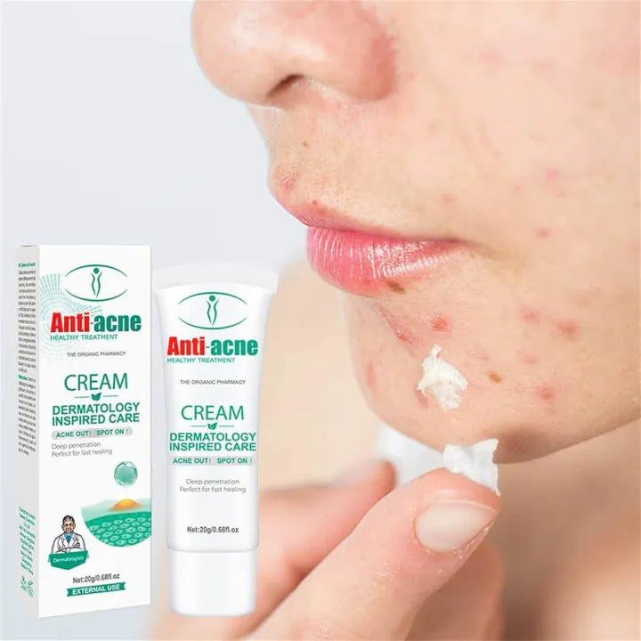 Acne Cream Soft Cream Texture, Moisturizing, Shrinking Pores, Repair ...