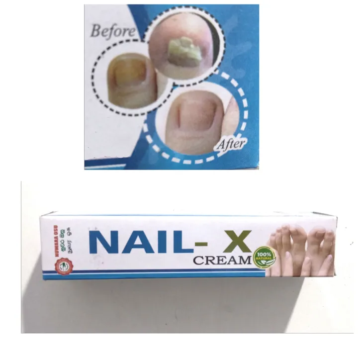 Nail - X Cream 20g 100% Natural Cream | Daraz.lk