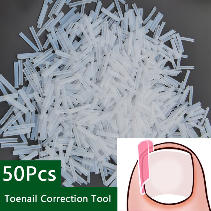 50Pcs/Box Ingrown Toenail Correction Strips Paronychia Correction ...