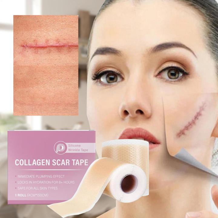 Scar Tape Keloid Removal Strip 1.6x59 Inch Silicone Scar Removal Strips ...