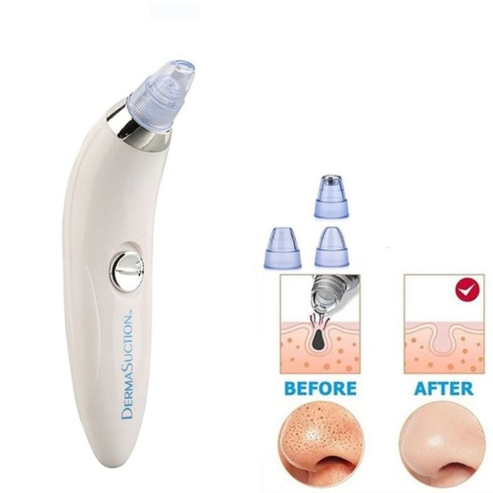 Blackhead Removal Machine 4 in 1 Black Head Remover Machine - Acne Pore ...