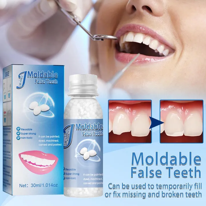 30ml Temporary Tooth Repair Moldable Teeth And Gaps False Tooth Solid ...