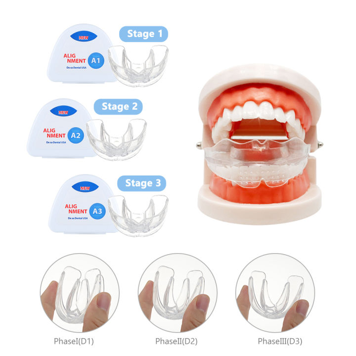 Orthodontic Retainers Braces 3-Stage Teeth Straightening Trainer for ...
