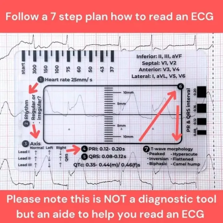 Ecg 7 Step Ruler 7 Step Scale For Ecg Observation Portable Transparent ...