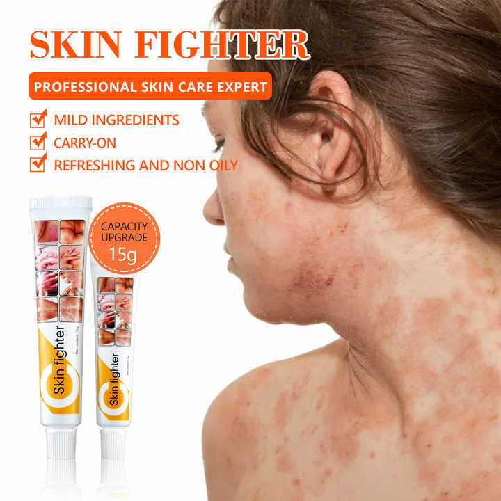 Professional Skin Care Cream Expert Skin Fighter for Psoriasis and ...