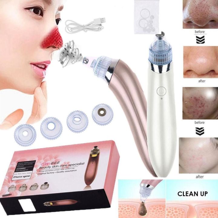 Derma Suction Rechargeable Blackhead Removal Machine Pimple Pore ...