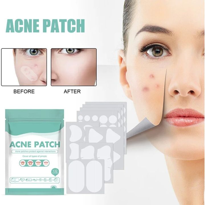 Acne Mask Patch Facial Treatment Desalinate Pimple Marks Pimple Patch ...