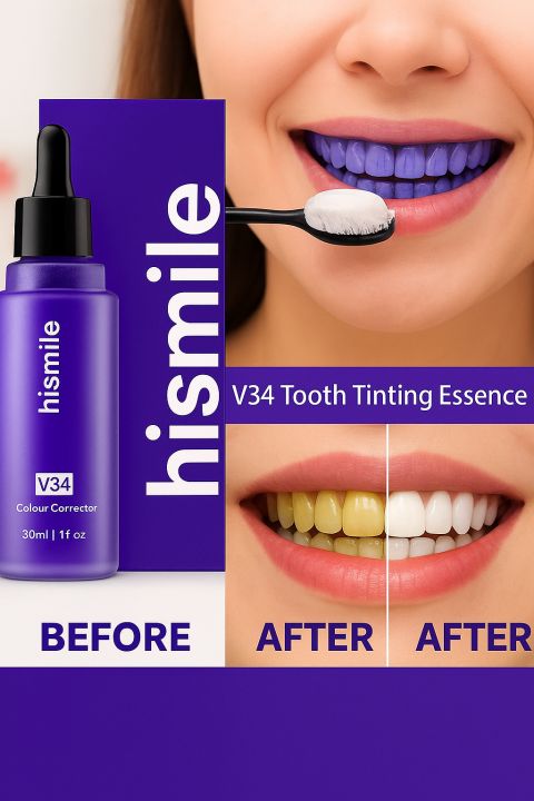 Hismile V34 Teeth Whitening Set | Hismile Original Purple Toothpaste ...