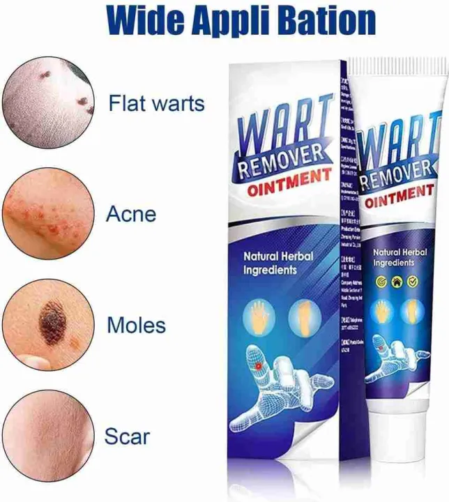 Wart Remover creaml | Skin Tag Remover cream | massa remover ointment ...