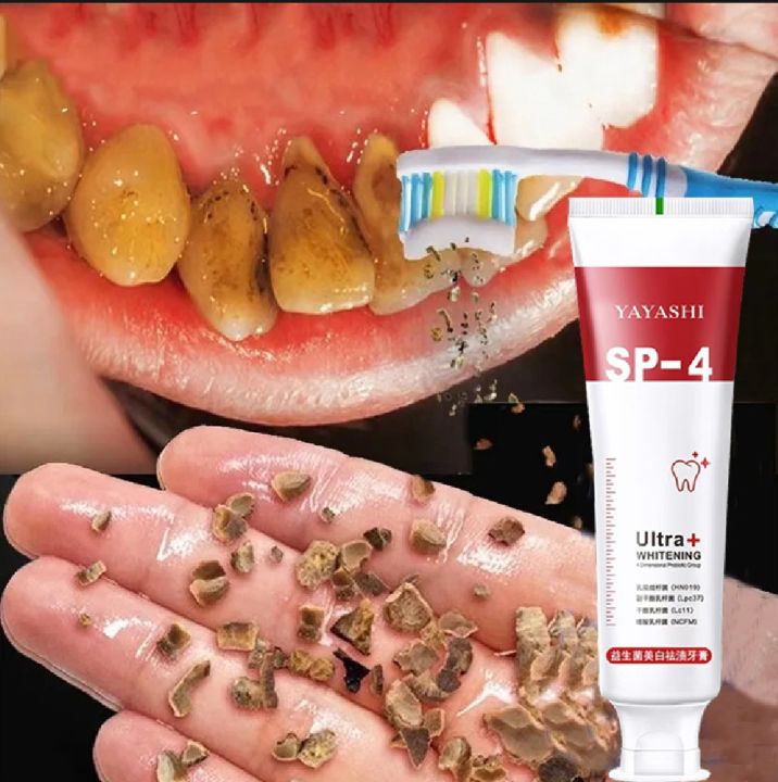 Strong Whitening Toothpaste SIP-4, 100g Probiotic Whitening Toothpaste ...