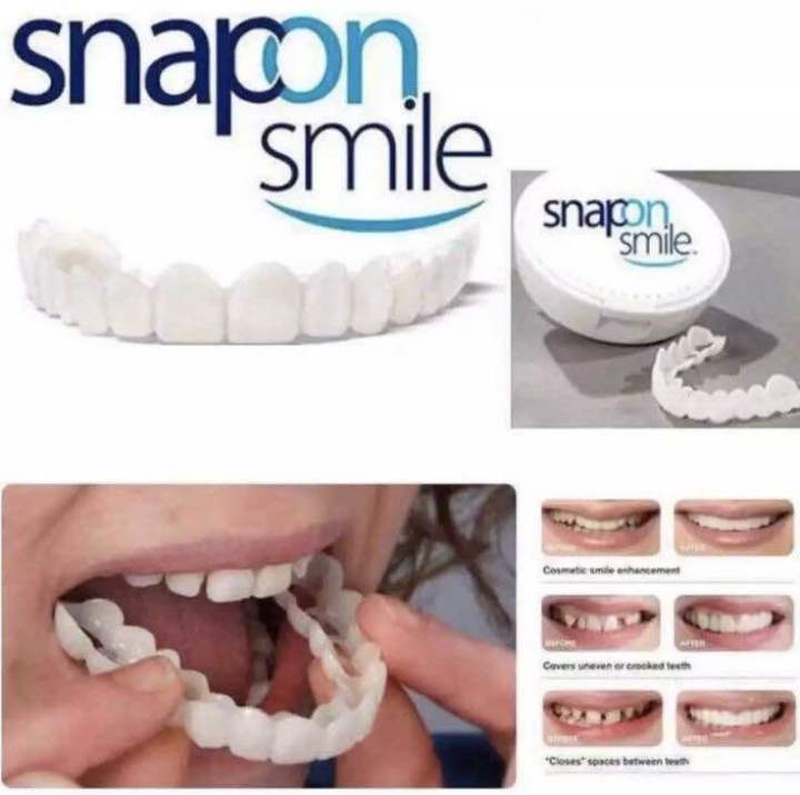 Snap-On Dental Veneers Teeth Braces | Transparent, Natural-Look Veneer ...