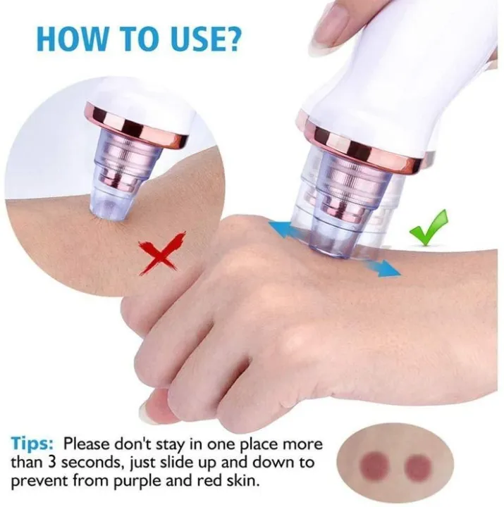 5 in 1 Electric Blackhead Acne Oil Remover Vacuum Suction Face Pore ...