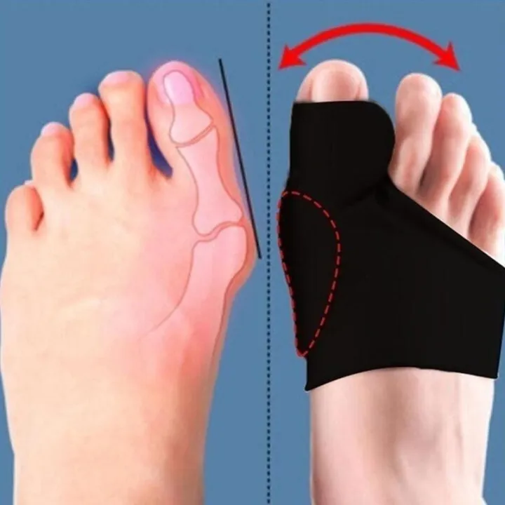 Cushion Heel Protector Insoles Valgus for Toe Finger Separator Feet ...