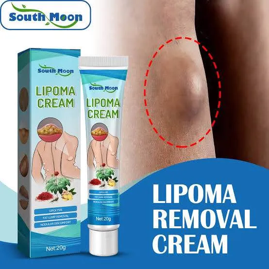 South Moon Lipoma Removal Cream Lipolysis Fat Lump Relieve Plaster Skin ...