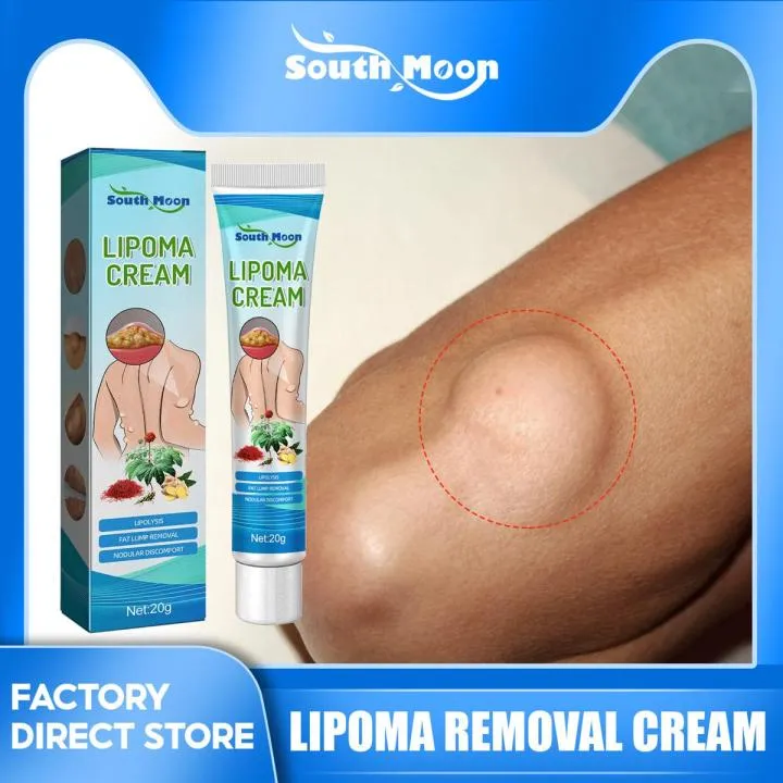 South Moon Lipoma Removal Cream Lipolysis Fat Lump Relieve Plaster Skin ...