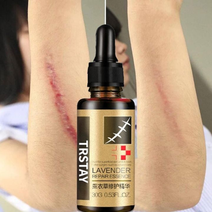 Lavender Repair Essence Scar Removal Scar Essential Massage Oil For ...