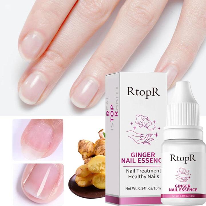 Nail Fungal Treatment Ginger Serum Anti Onychomycosis Nourishing ...